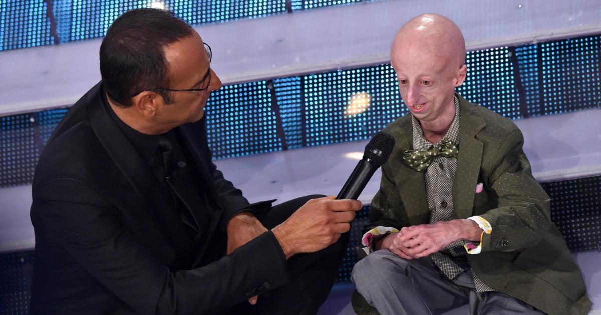 E' morto a 28 anni Sammy Basso: era il più longevo malato di progeria ...